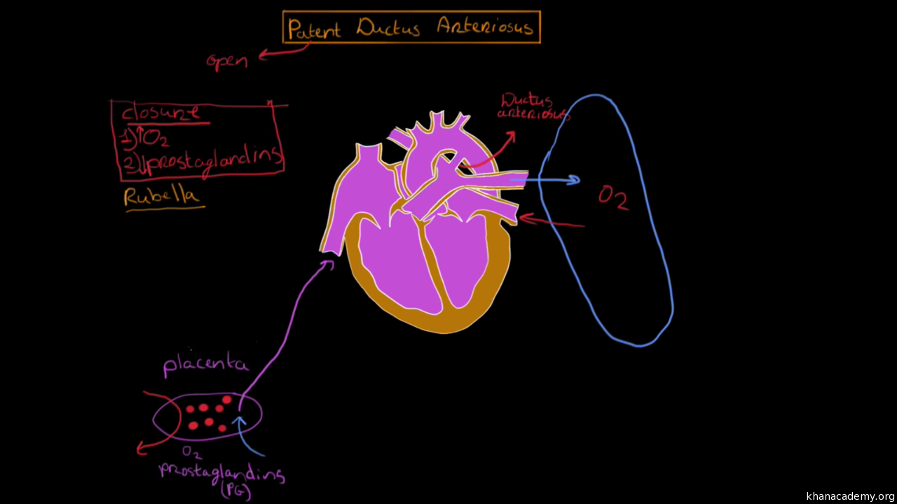Ductus Arteriosus