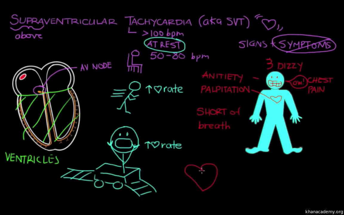 Supraventricular Tachycardia Svt Causes Symptoms