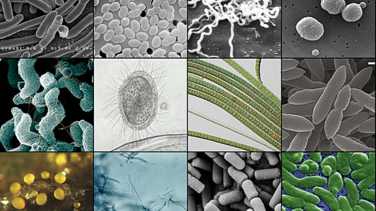 Prokaryotic cells (practice) | Khan Academy